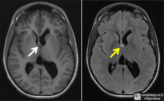 Learningradiology